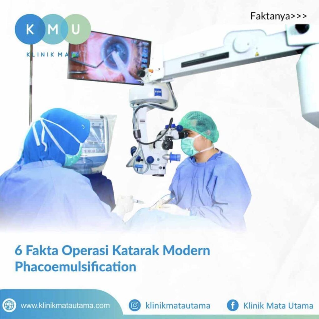 6 Fakta Operasi Katarak Modern Phacoemulsification