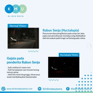 3 Gejala Rabun Senja (Nyctalopia), Waspadai!