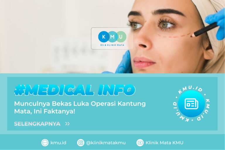 Munculnya Bekas Luka Operasi Kantung Mata, Ini Faktanya!