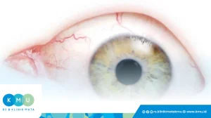 Bagian Putih di Mata: Mengenal Peran dan Fungsi Sklera