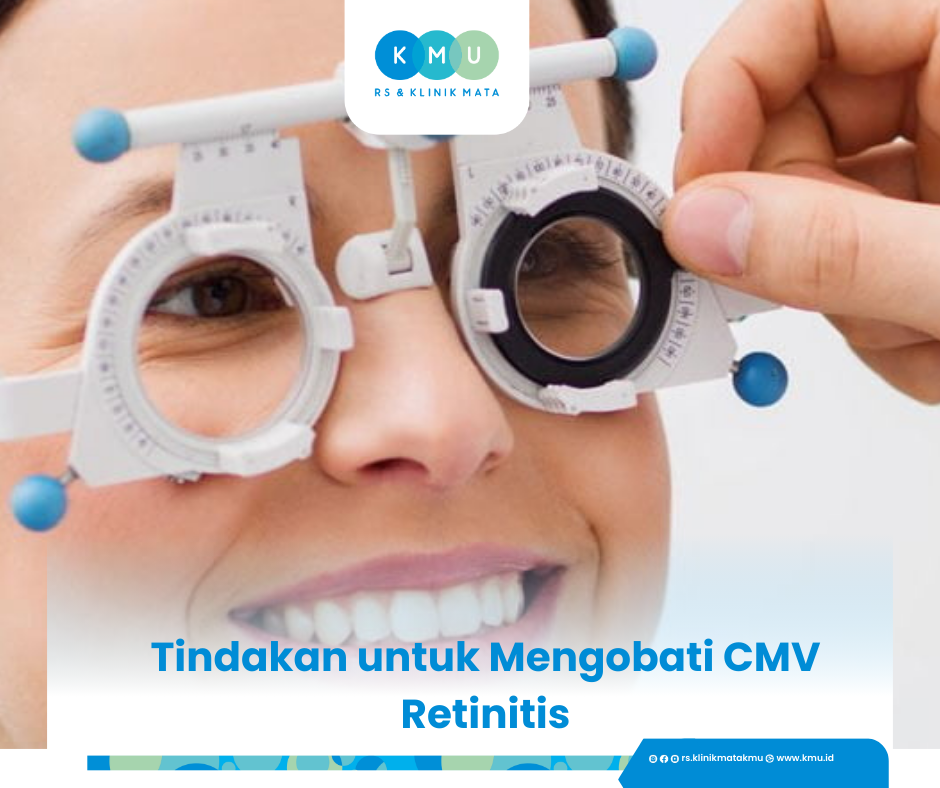 cmv retinitis