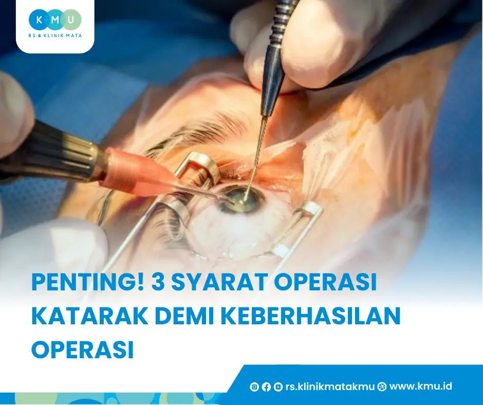 Penting! 3 Syarat Operasi Katarak Demi Keberhasilan Operasi